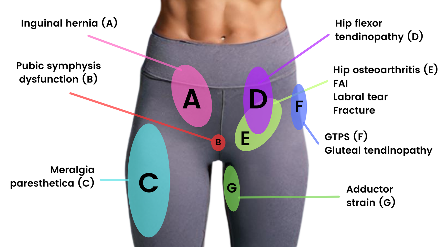 Understanding Hip Pain: Causes, Diagnosis, and Treatment